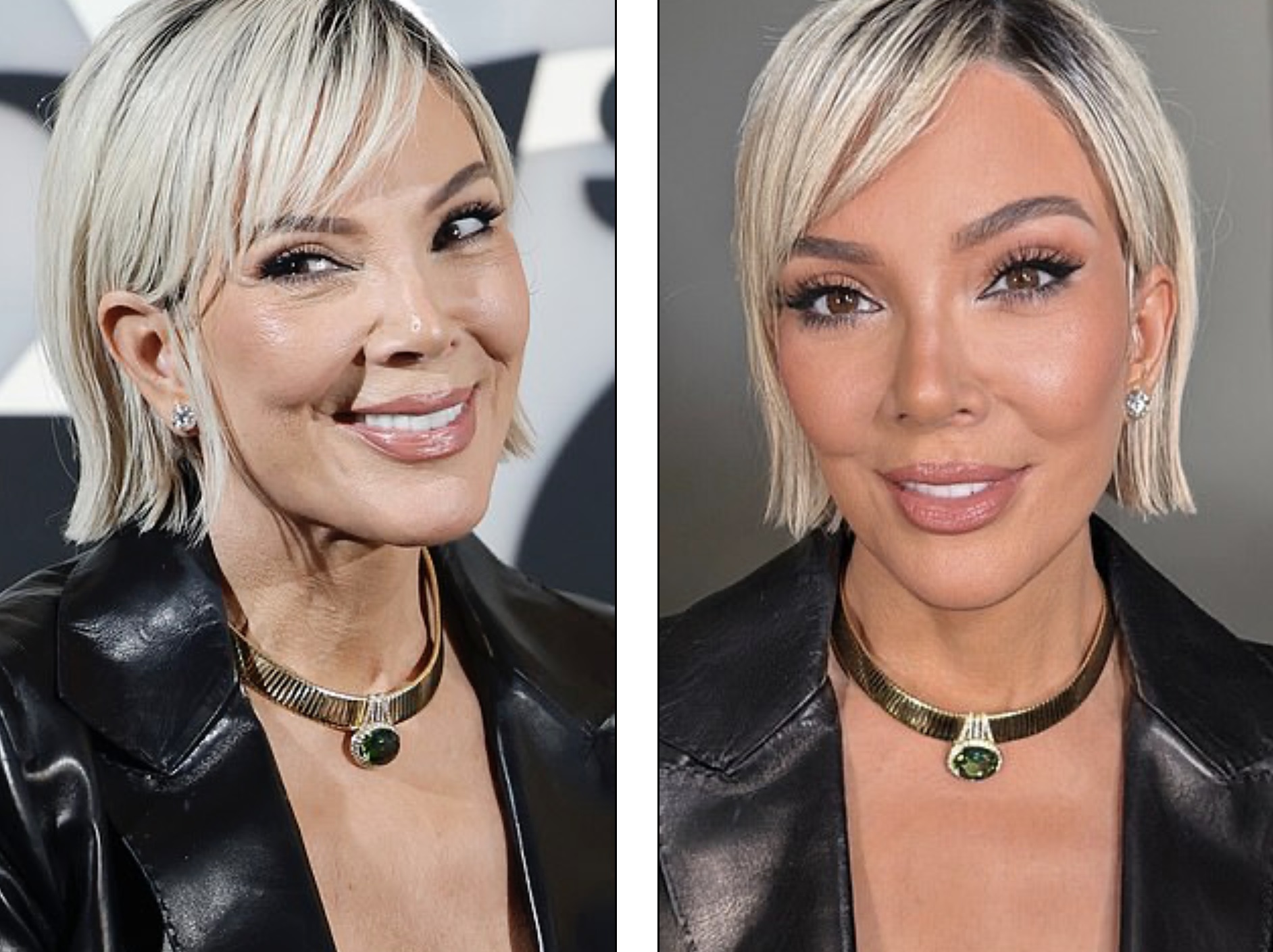 Kris Jenner Left Reeling After Her Latest Plastic Surgery Exposed In ...